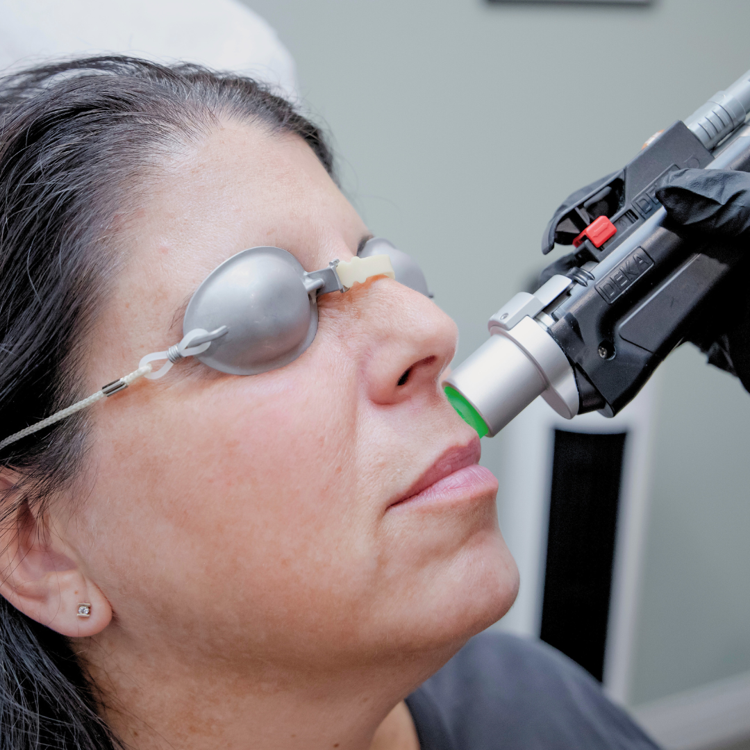 Glow & Go Laser Facial | Mint & Needle