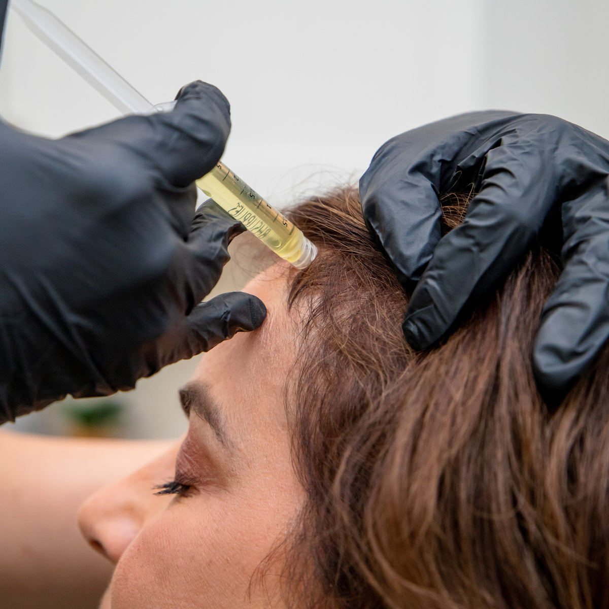 PDGF Injection (Patient Appreciation Promo 2025) – Mint & Needle